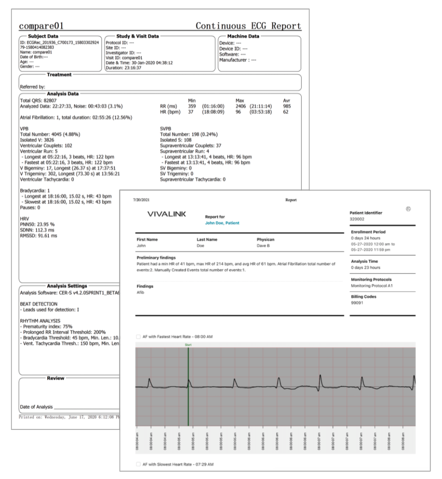 Wearable Cardiac Event Monitor - Arrhythmia Detection - Vivalink
