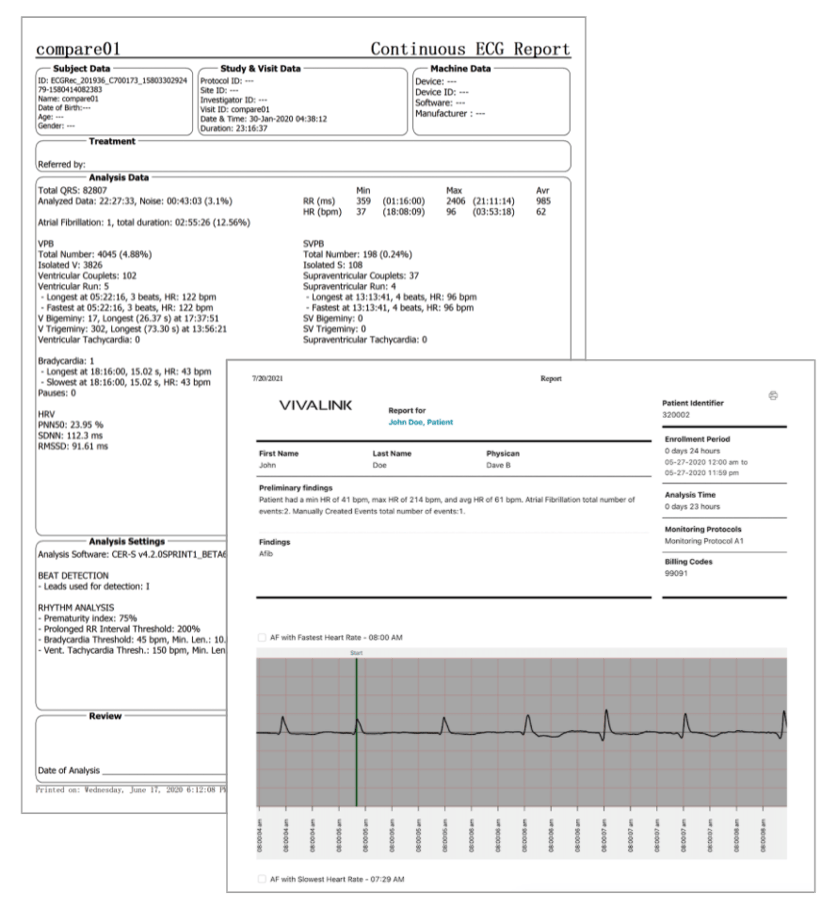 Wearable Cardiac Event Monitor - Arrhythmia Detection - Vivalink