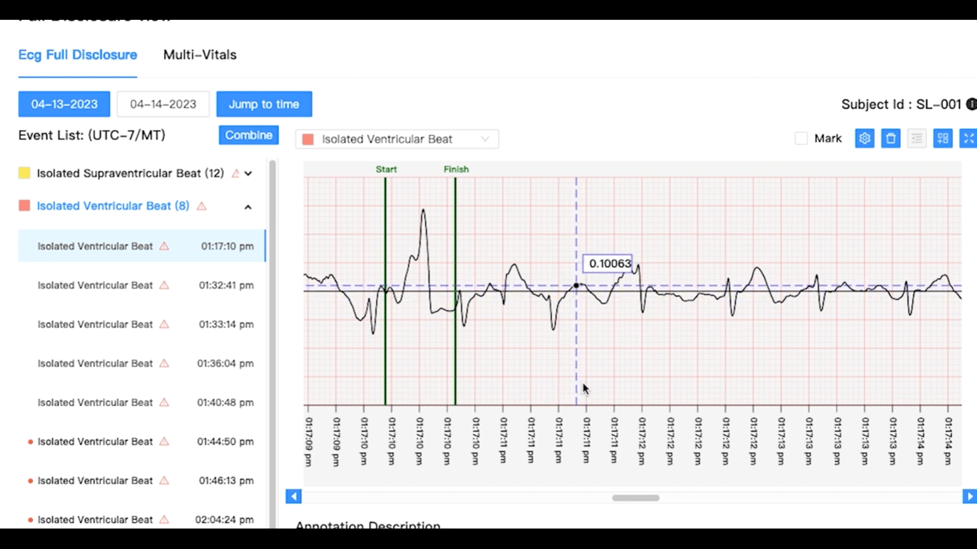 Acute Remote Patient Monitoring System