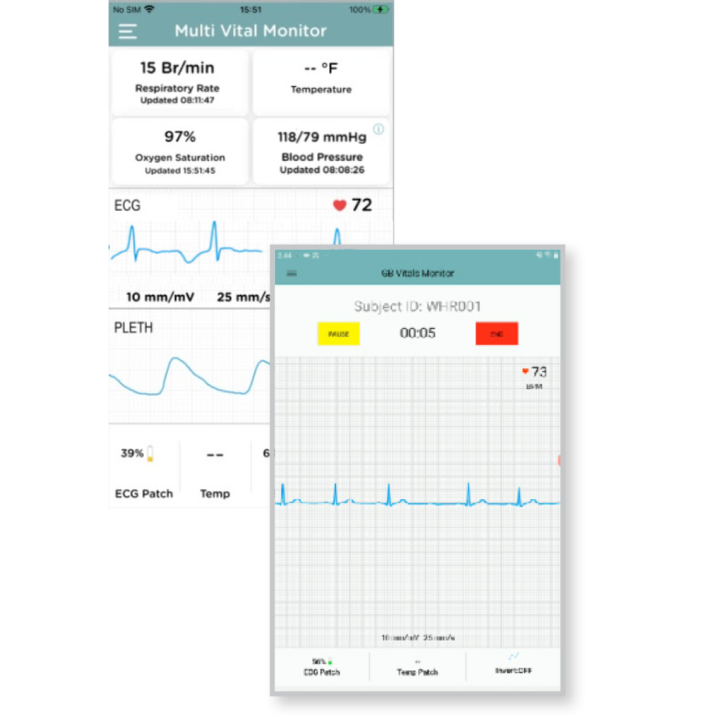 Six-Minute Walk Test (6MWT): Live Vitals & Multi-Patient Monitoring ...